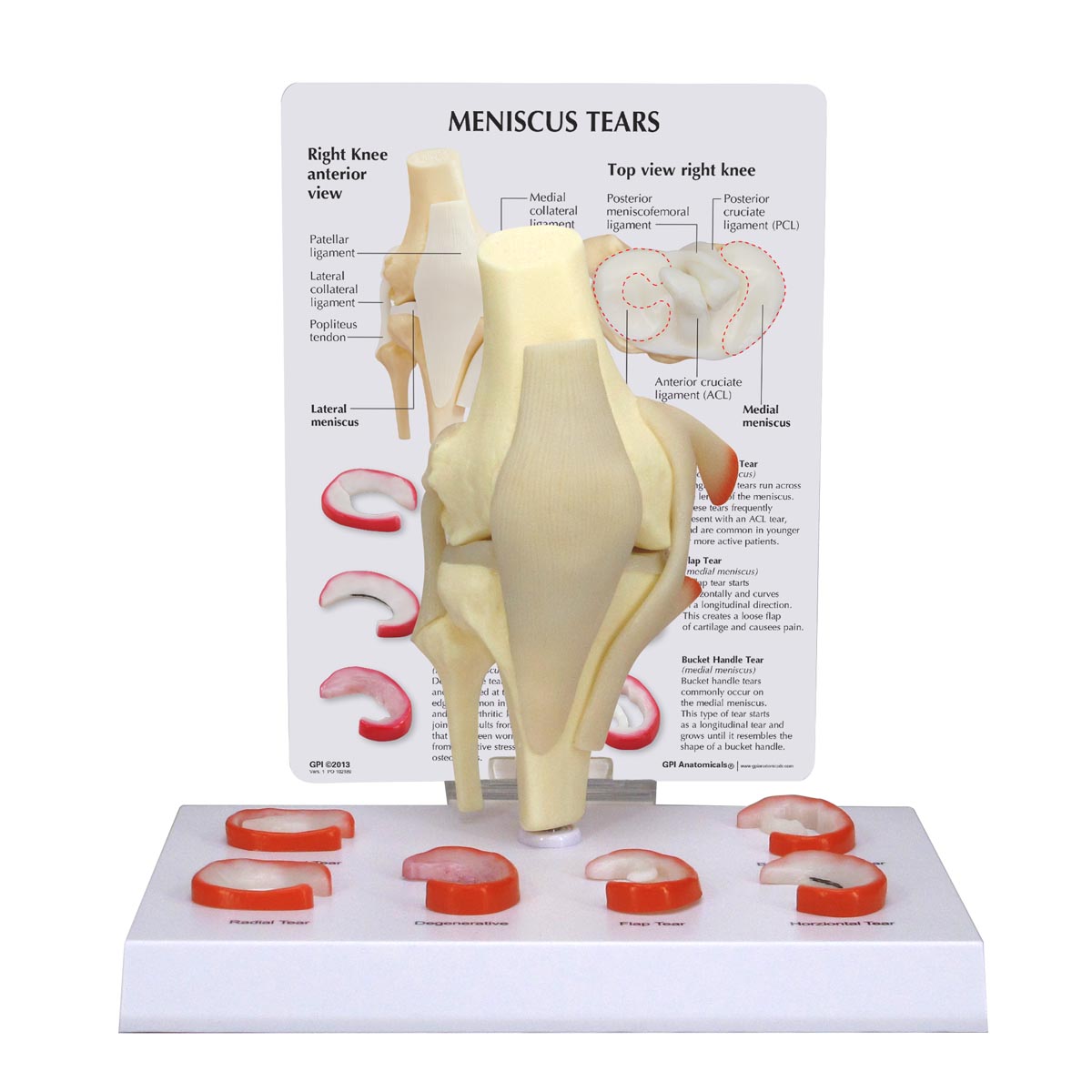 Meniscus Knee Model with 6 Tears - SEM Trainers