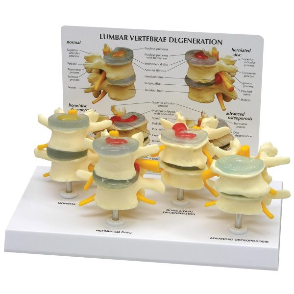 Sacrum -T8 Spine Model - SEM Trainers