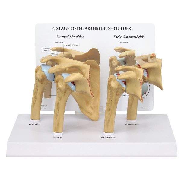 Human Shoulder Joint Model with Rotator Cuff & 4 Removable Muscles, 5 ...