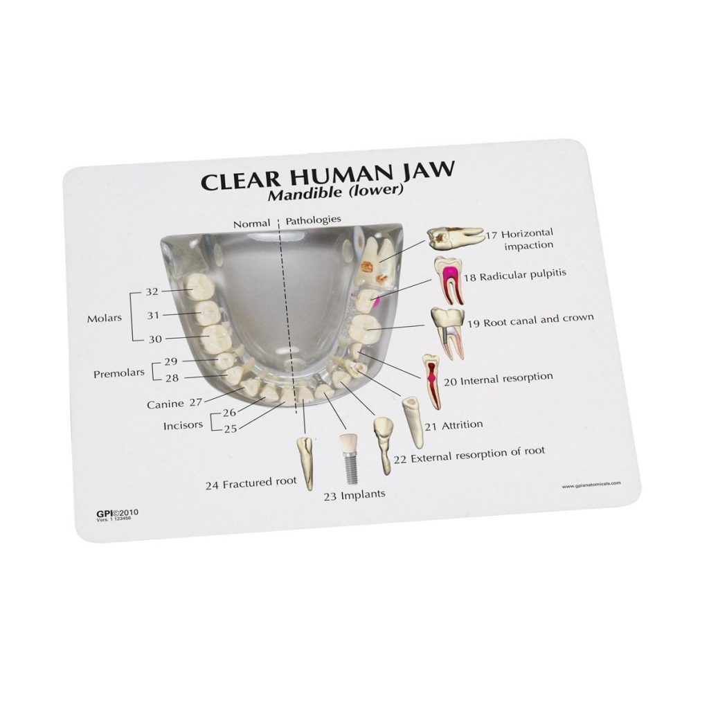 Comprehensive Lower Jaw Model (Left Half) with Diseased Teeth, Nerves ...