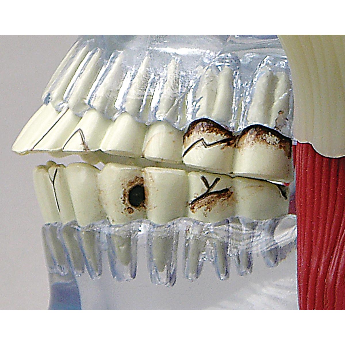 TMJ Model - SEM Trainers