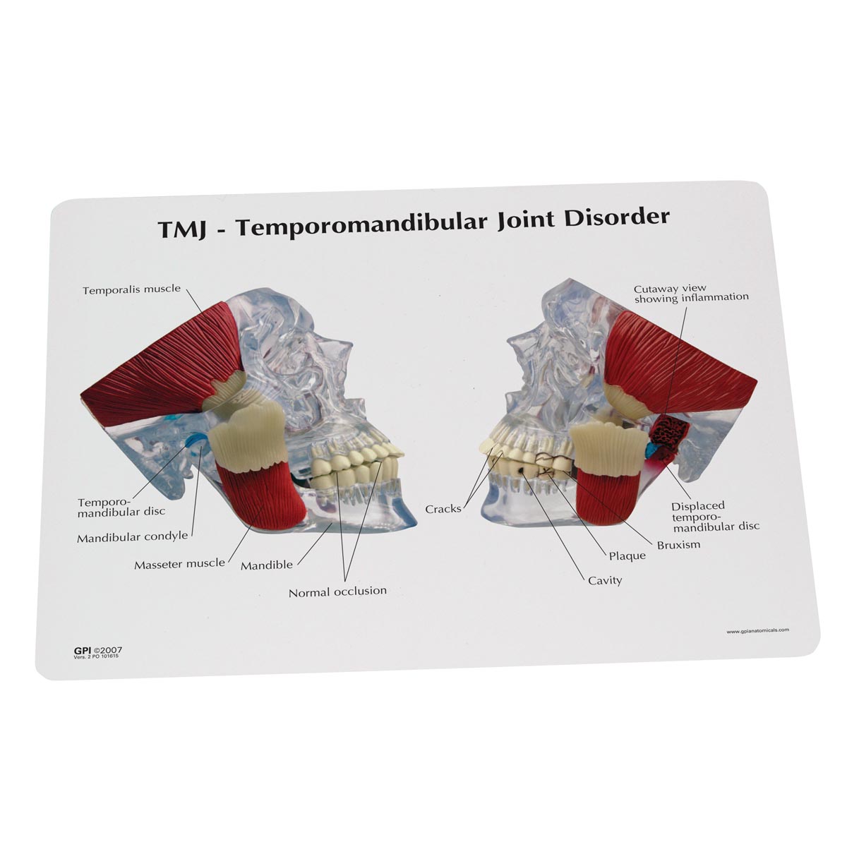 TMJ Model - SEM Trainers