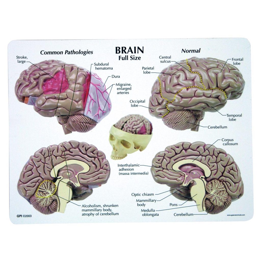 Human Brain Ventricle Model - 3B Smart Anatomy - SEM Trainers