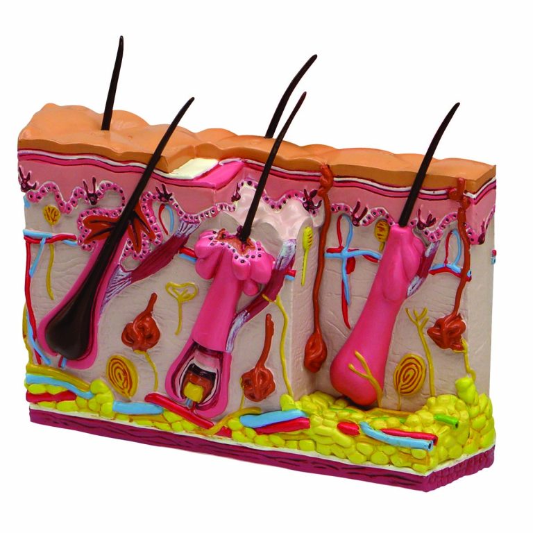 Human Skin Series with Burn Pathologies, 75 times life size - SEM Trainers