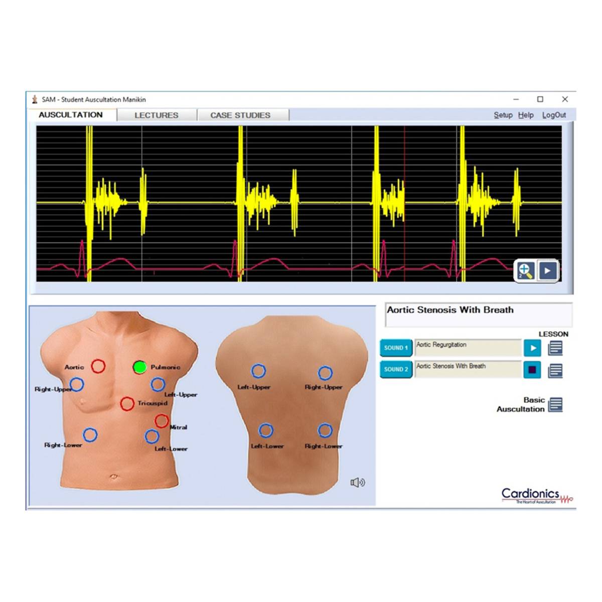 SAM 3G® Student Auscultation Manikin - Auscultation Simulator - SAM 3G ...