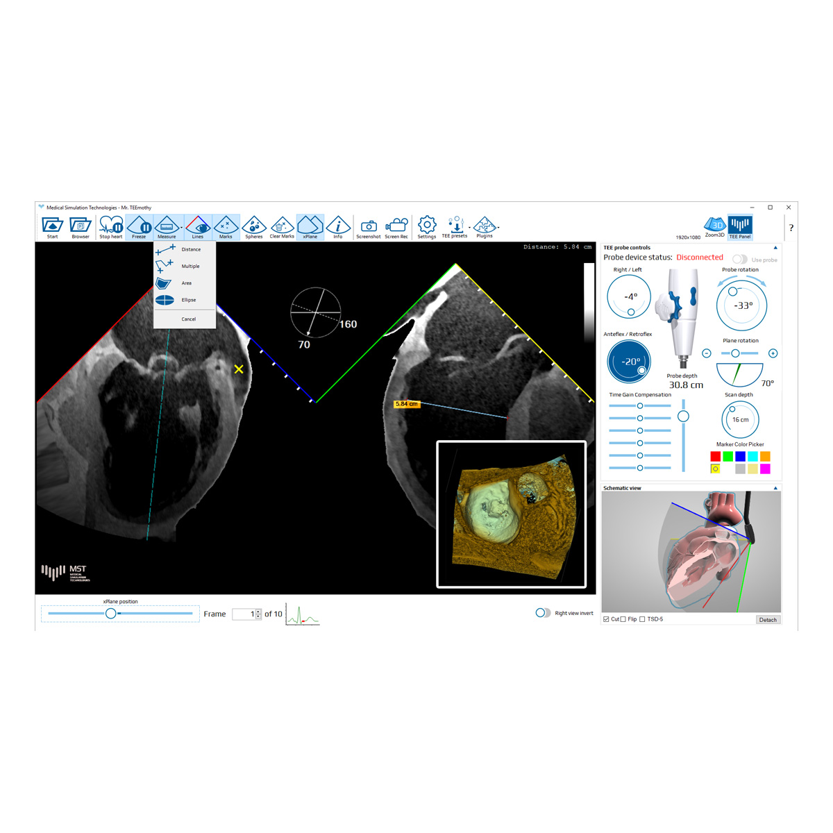 MrTEEmothy® Standard Transesophageal Echocardiography Simulator - SEM ...