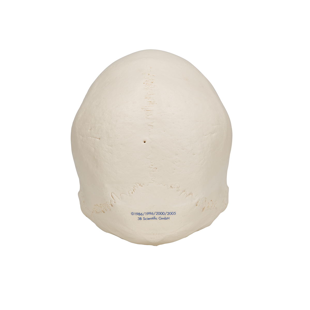 Microcephalic Human Skull Model - SEM Trainers