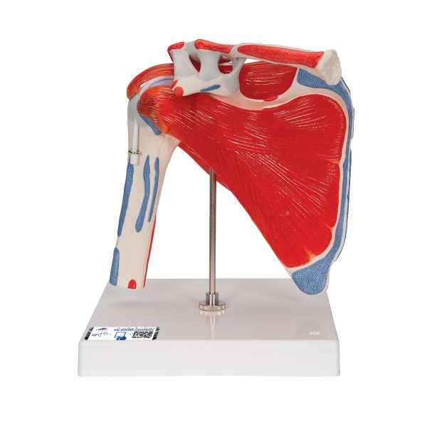 Human Femoral Fracture & Hip Osteoarthritis Model - 3B Smart Anatomy ...