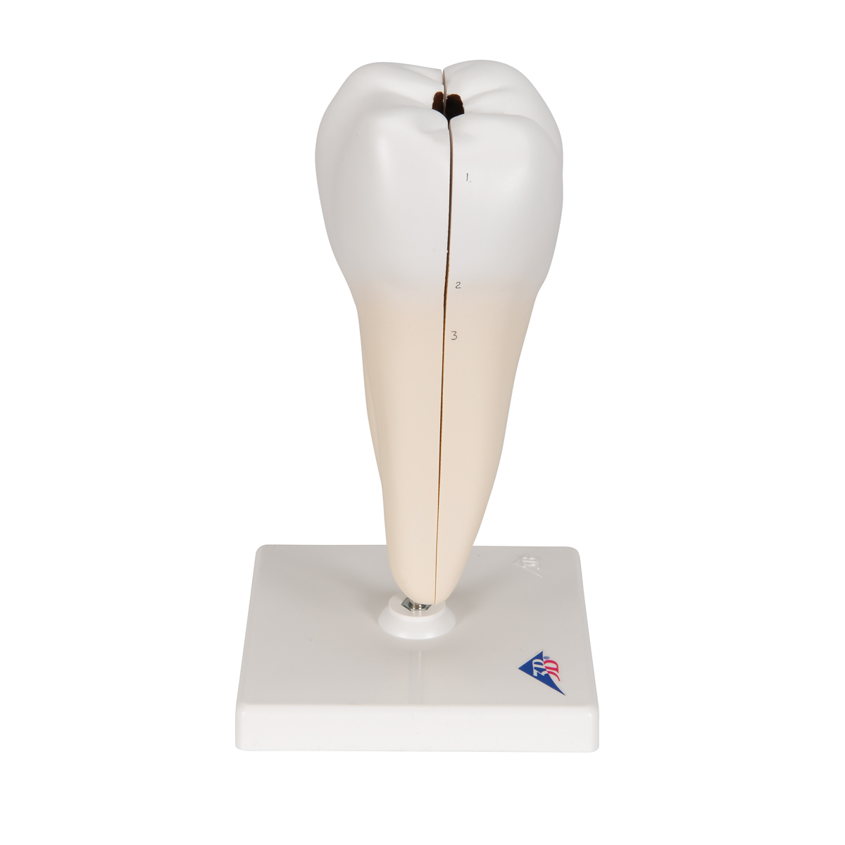 Lower Twin-Root Molar with Cavities Human Tooth Model, 2 part - 3B ...