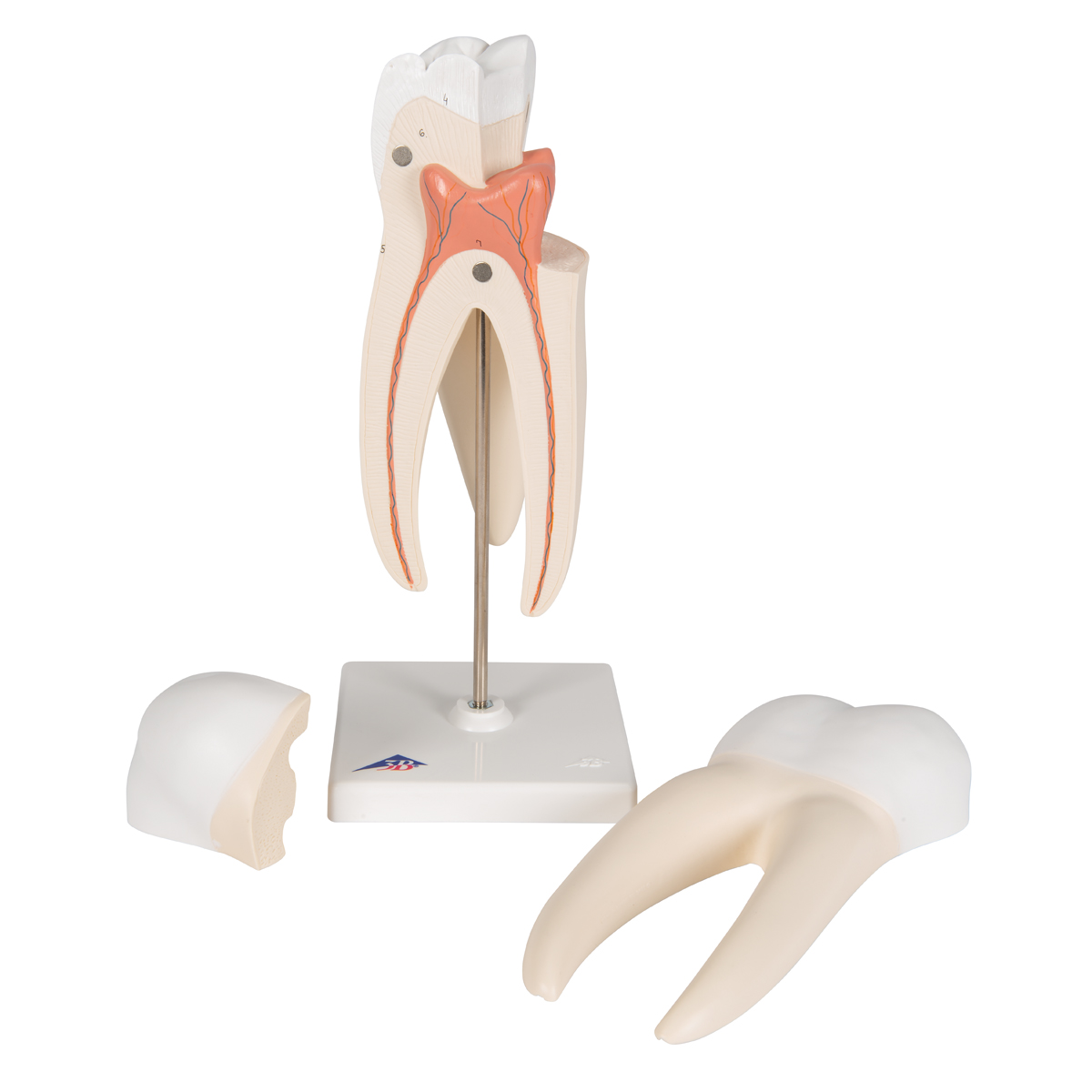 Upper Triple-Root Molar Human Tooth Model, 3 part - 3B Smart Anatomy ...