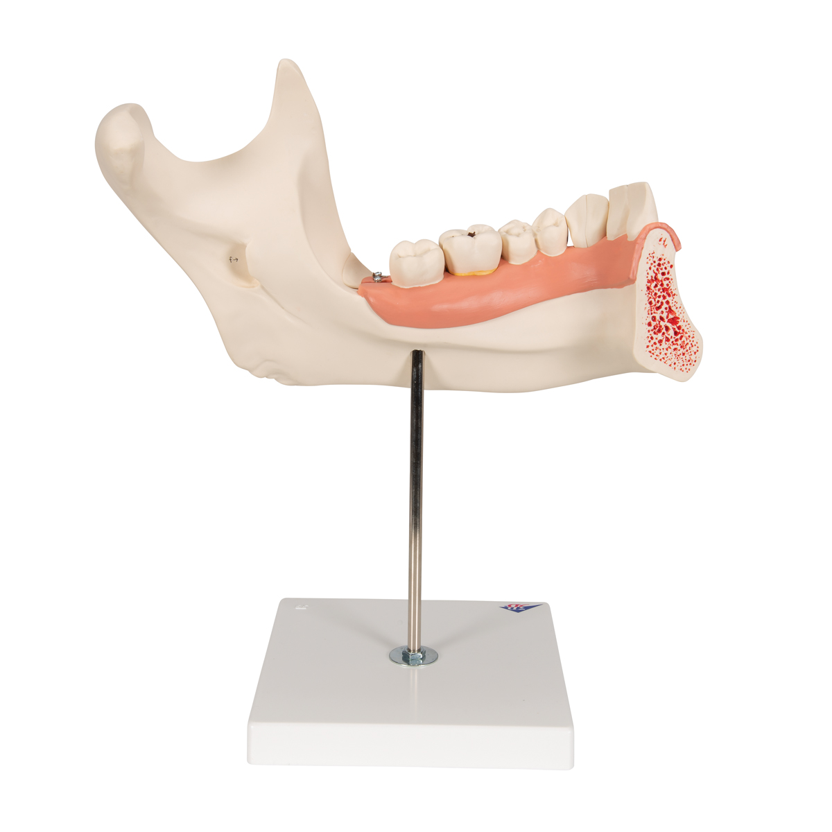 Half Lower Human Jaw Model, 3 times Full-Size, 6 part - 3B Smart ...
