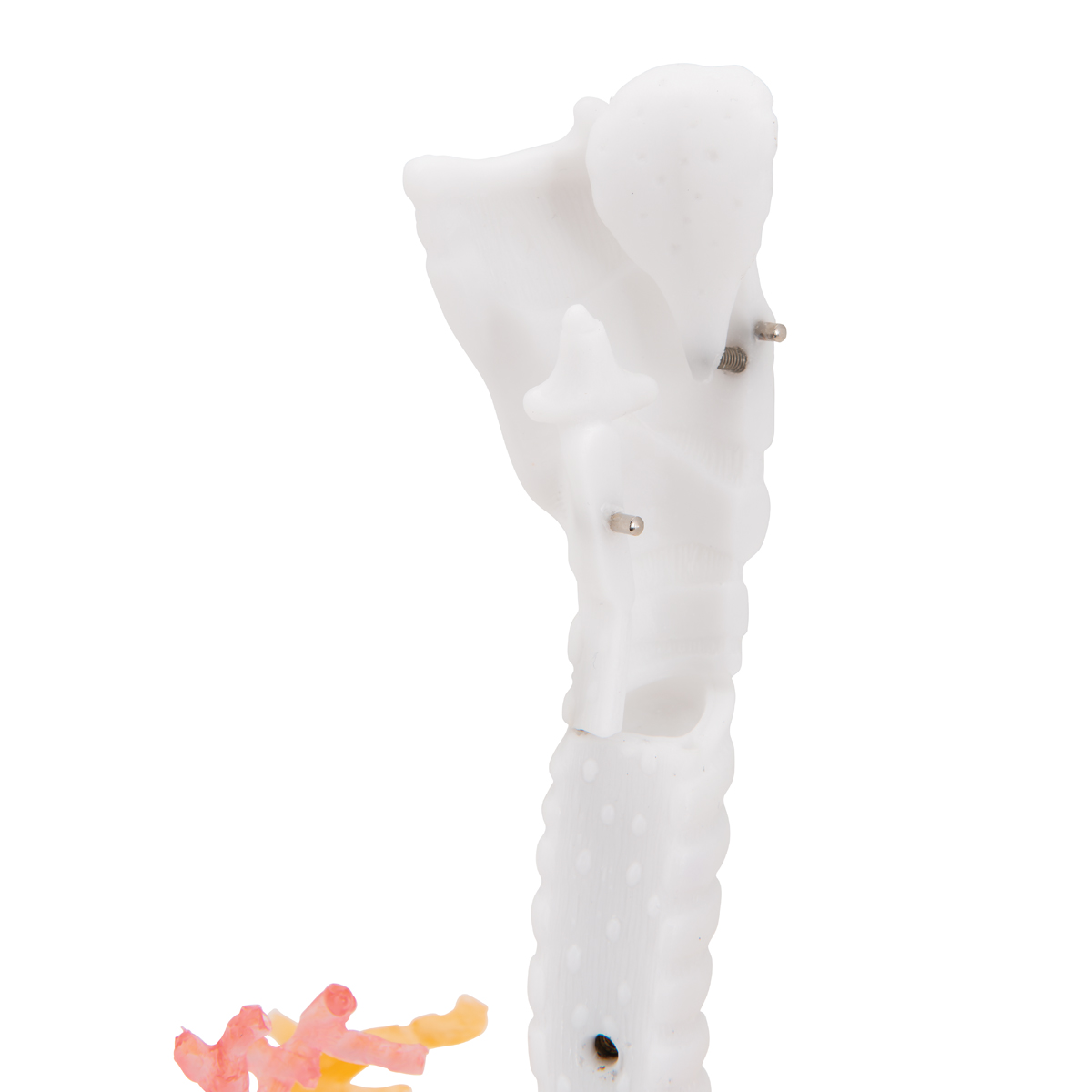 CT Bronchial Tree Model with Larynx - 3B Smart Anatomy - SEM Trainers