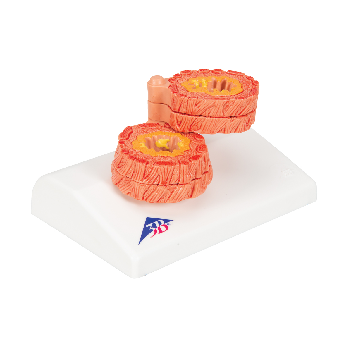 COPD Bronchial Tissue Model - 3B Smart Anatomy - SEM Trainers