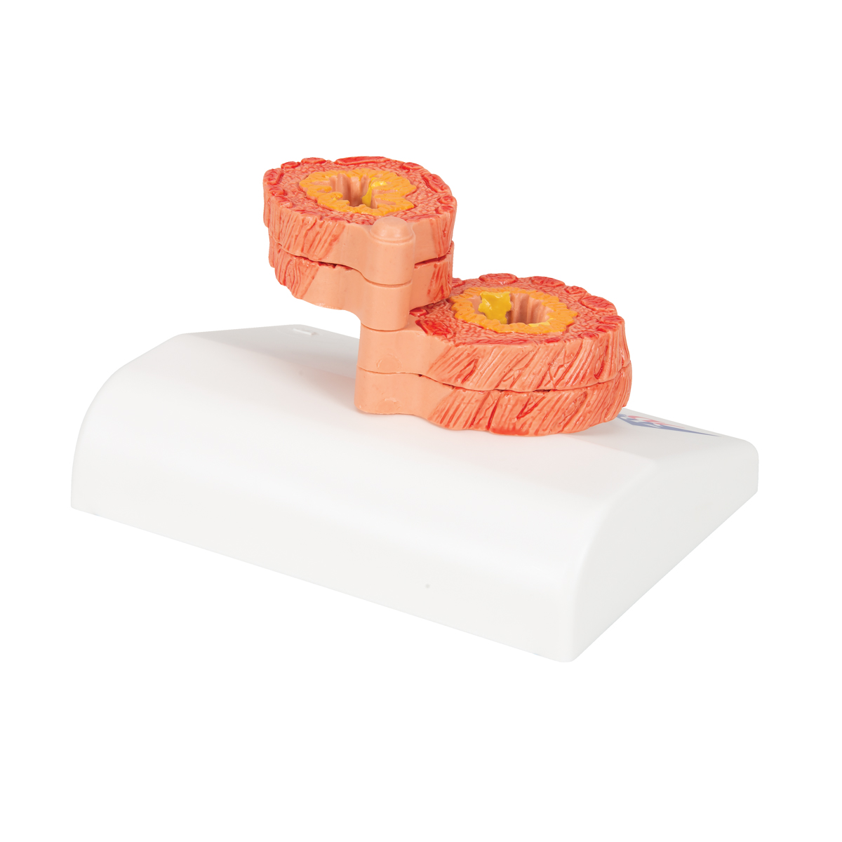 COPD Bronchial Tissue Model - 3B Smart Anatomy - SEM Trainers