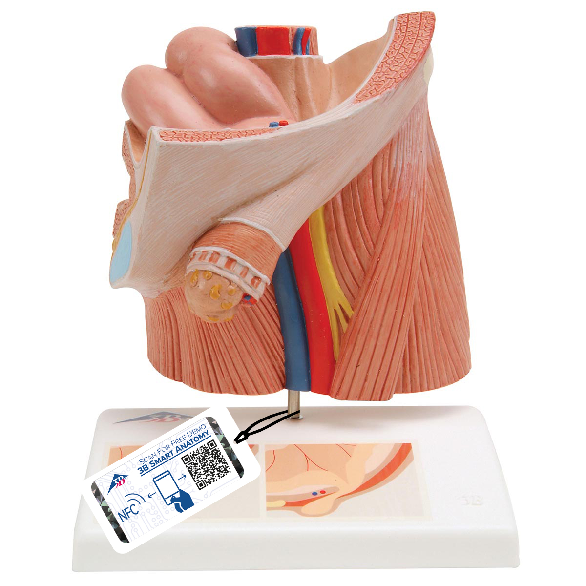 Inguinal Hernia Urology Model - 3B Smart Anatomy - SEM Trainers