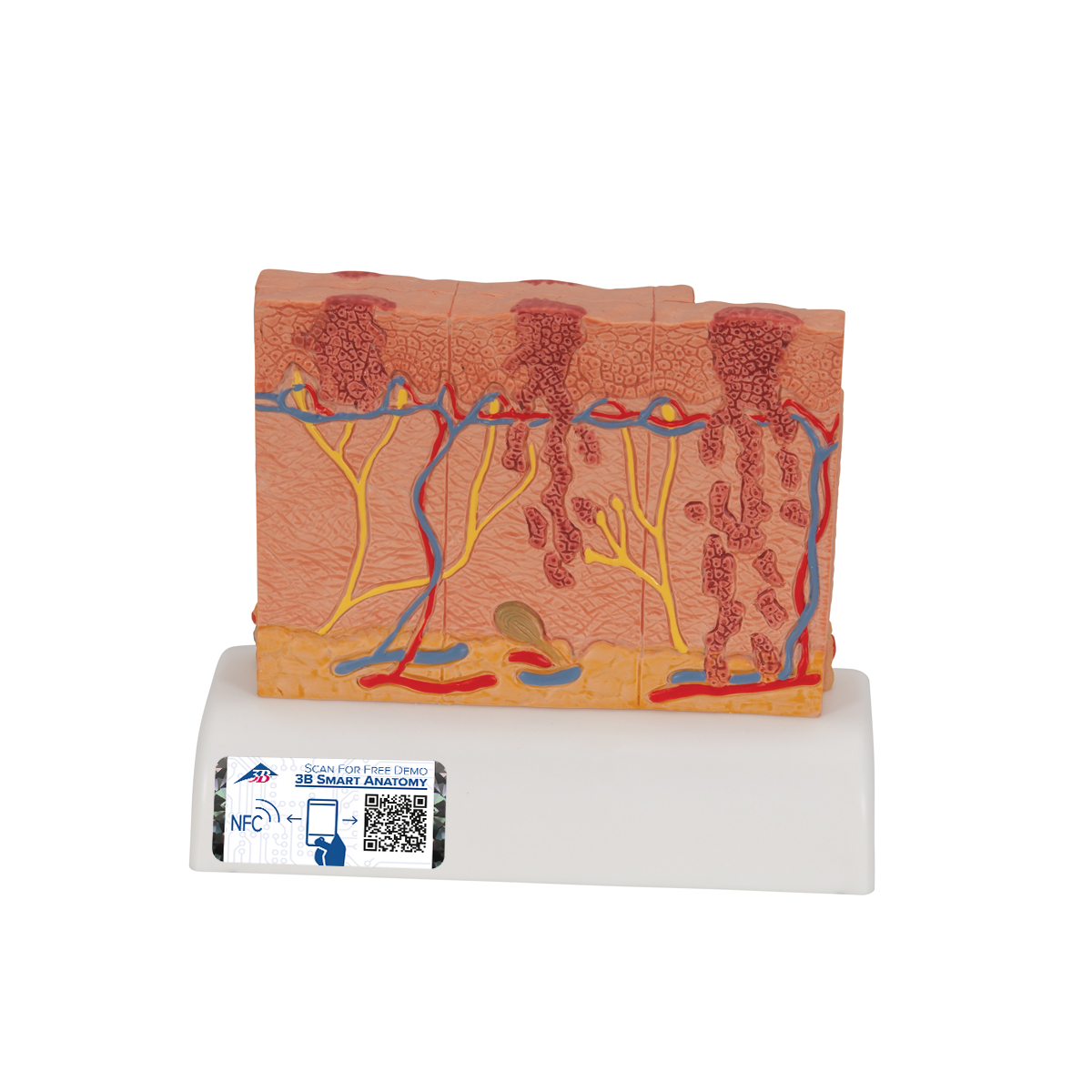 Skin Cancer Model with 5 stages, 8 times magnified - 3B Smart Anatomy ...