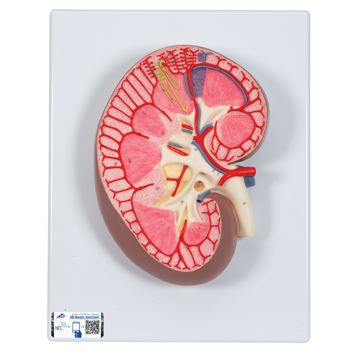 Kidney Section Model, 3 times Full-Size - 3B Smart Anatomy - SEM Trainers
