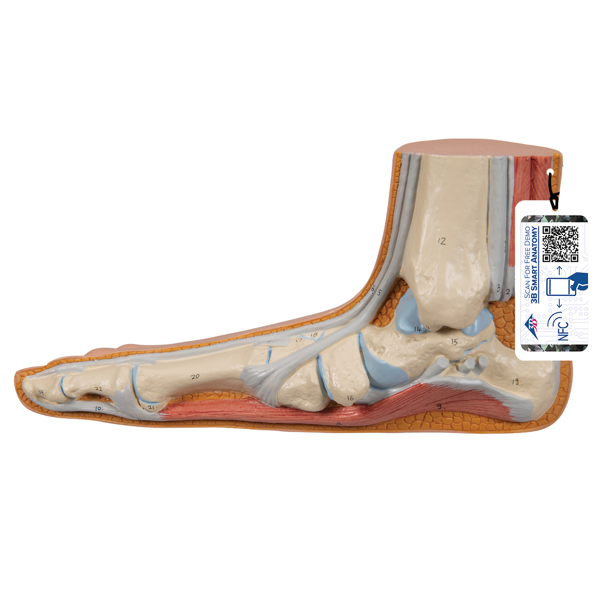 Flat Foot (Pes Planus) Model - 3B Smart Anatomy - SEM Trainers