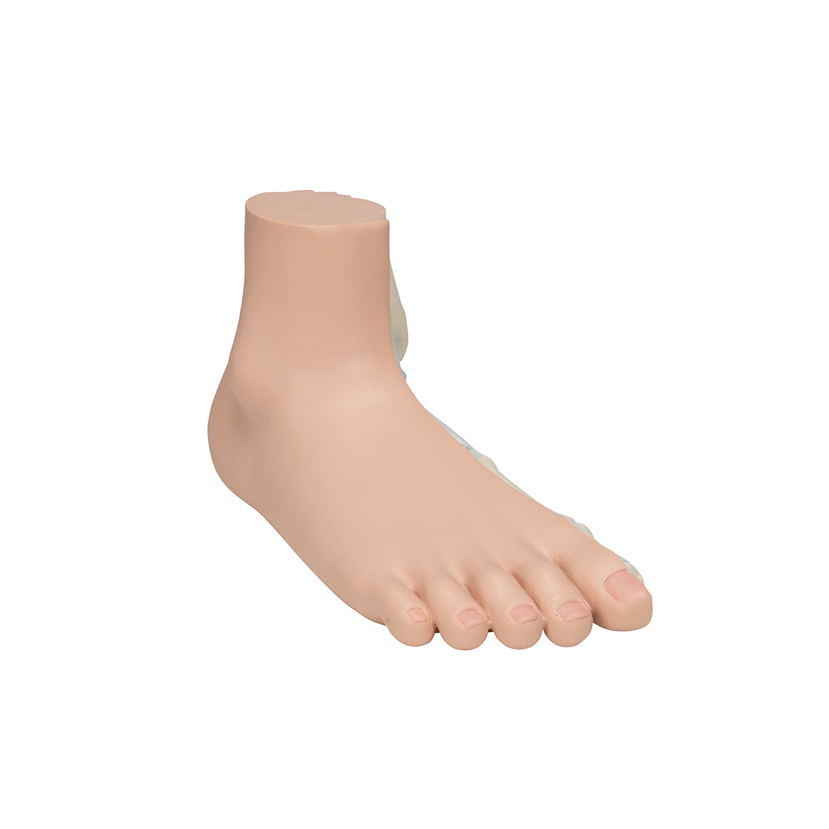 Flat Foot (Pes Planus) Model - 3B Smart Anatomy - SEM Trainers
