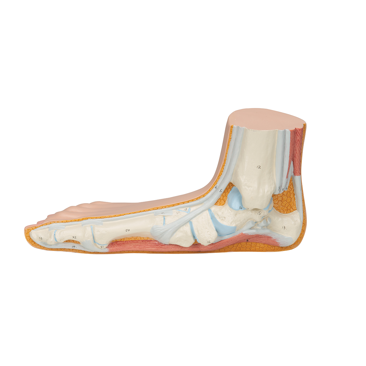 Flat Foot (Pes Planus) Model - 3B Smart Anatomy - SEM Trainers