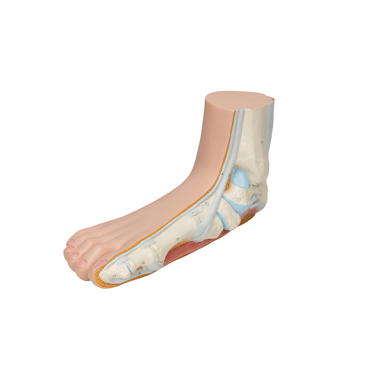 Flat Foot (Pes Planus) Model - 3B Smart Anatomy - SEM Trainers