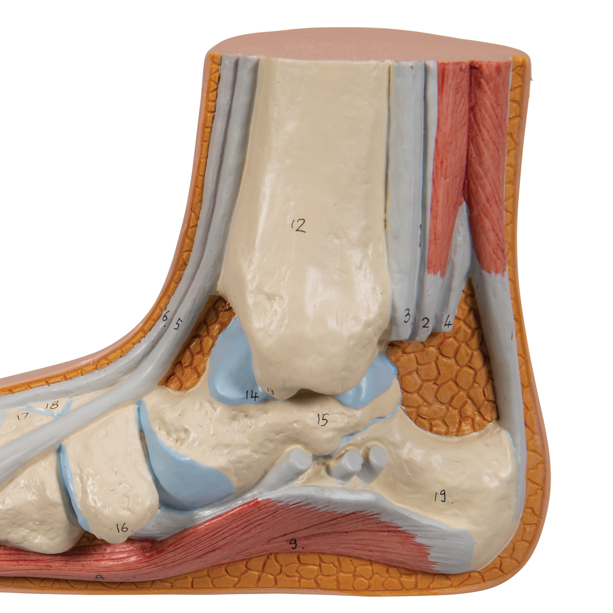Flat Foot (Pes Planus) Model - 3B Smart Anatomy - SEM Trainers