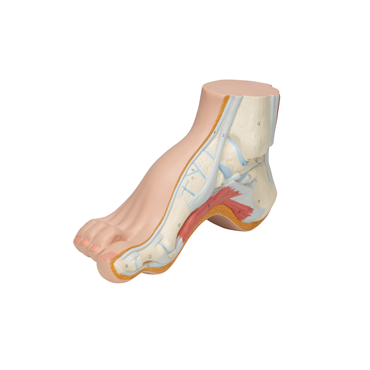 Hollow Foot (Pes Cavus) Model - 3B Smart Anatomy - SEM Trainers