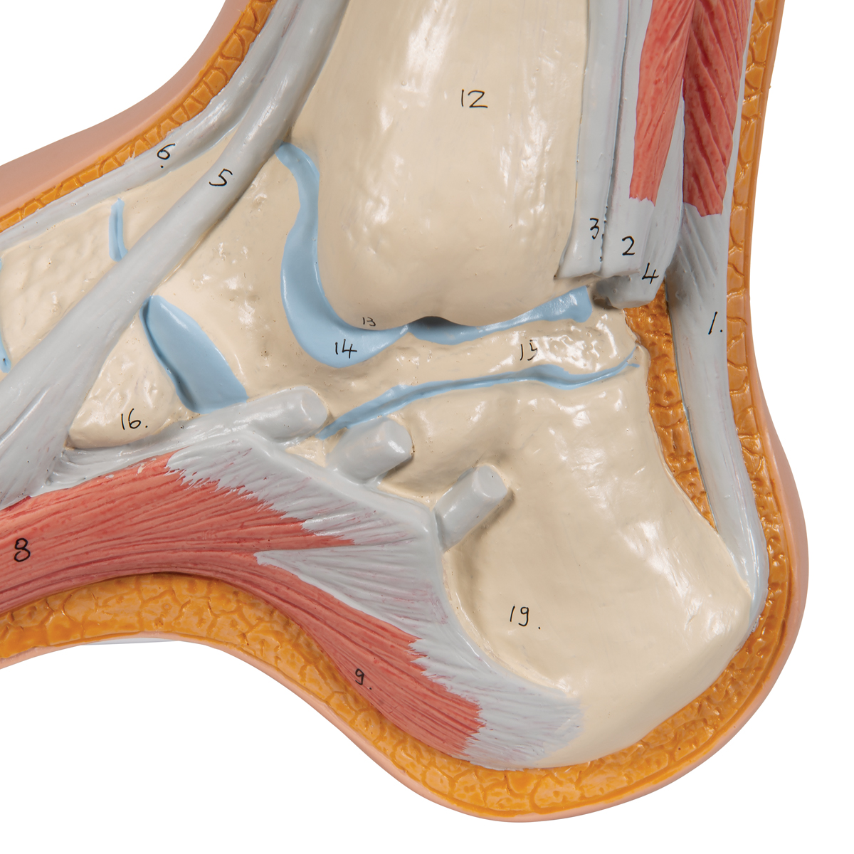 Hollow Foot (Pes Cavus) Model - 3B Smart Anatomy - SEM Trainers
