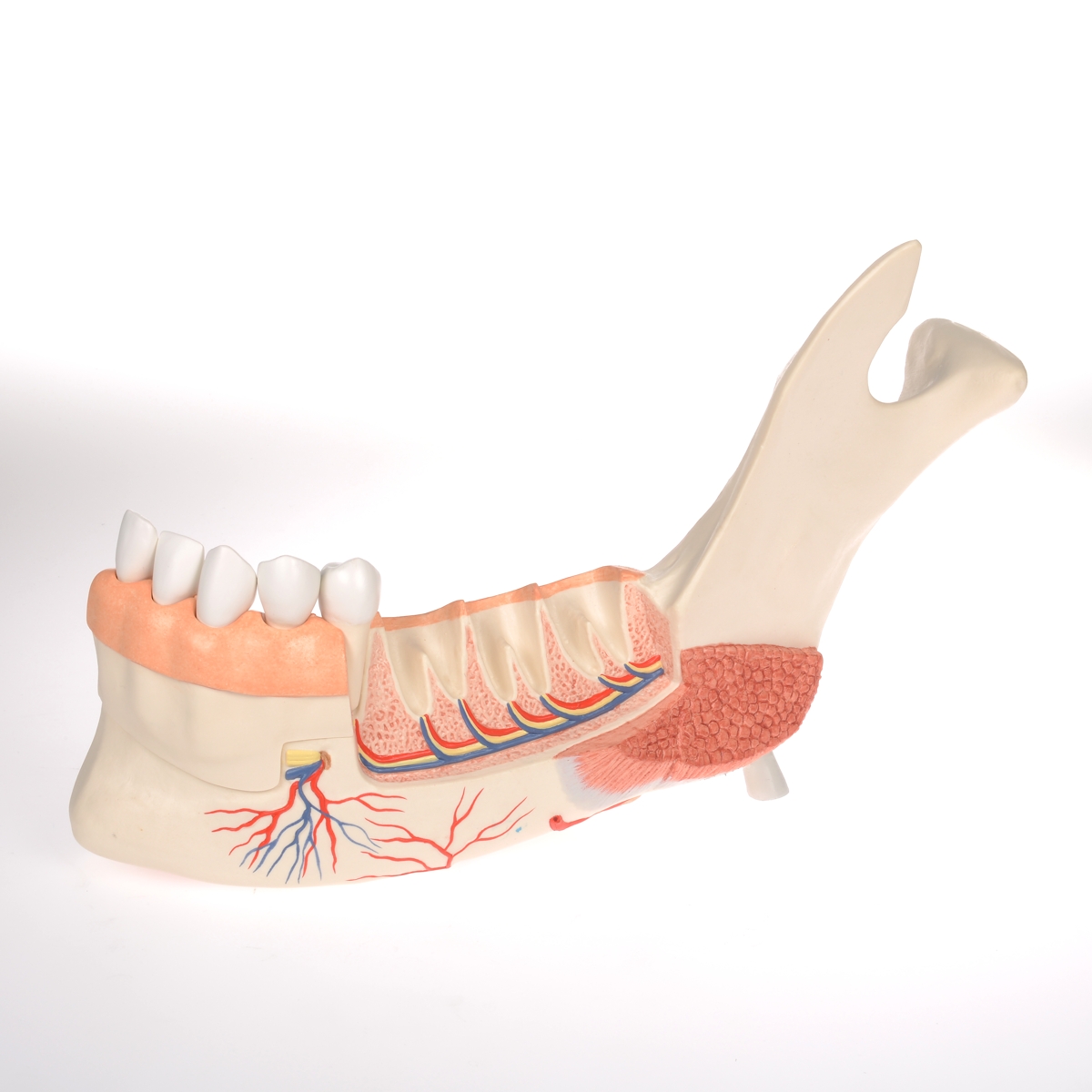 Comprehensive Lower Jaw Model (Left Half) with Diseased Teeth, Nerves ...