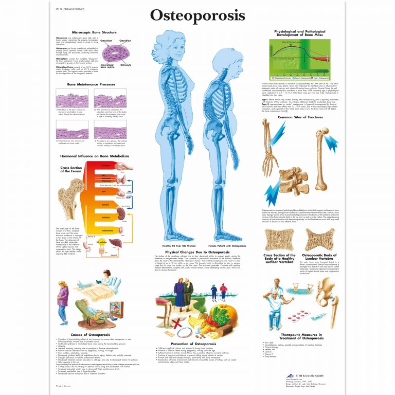 Arthritis Chart - SEM Trainers
