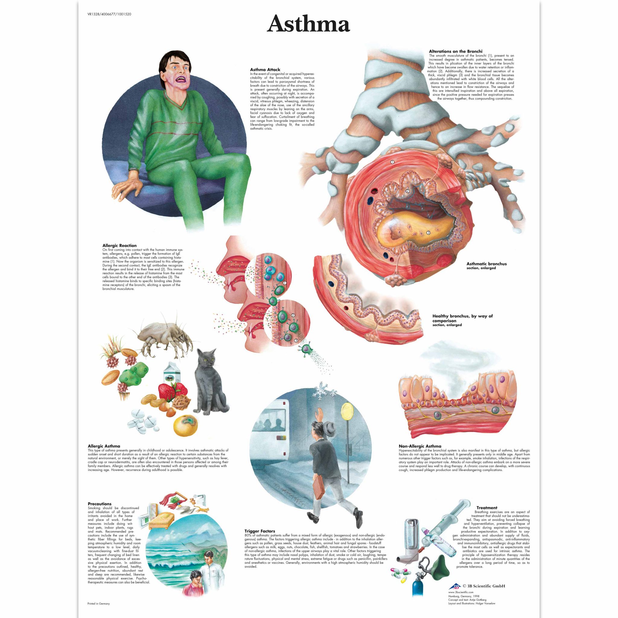 COPD Chart - Chronic Obstructive Pulmonary Disease - SEM Trainers