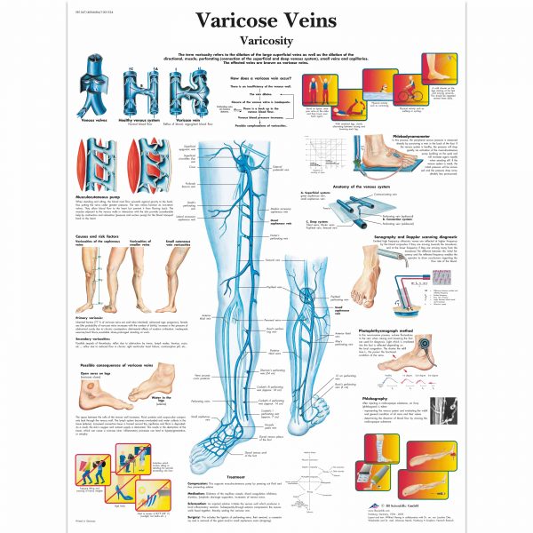 Deep Vein Thrombosis Chart - SEM Trainers