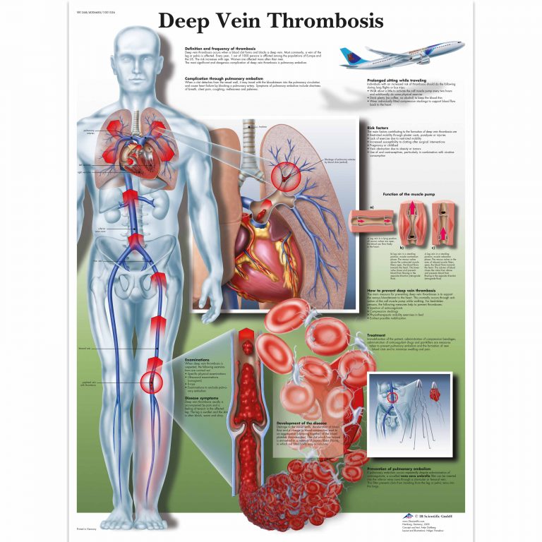 The Vascular System Chart - SEM Trainers