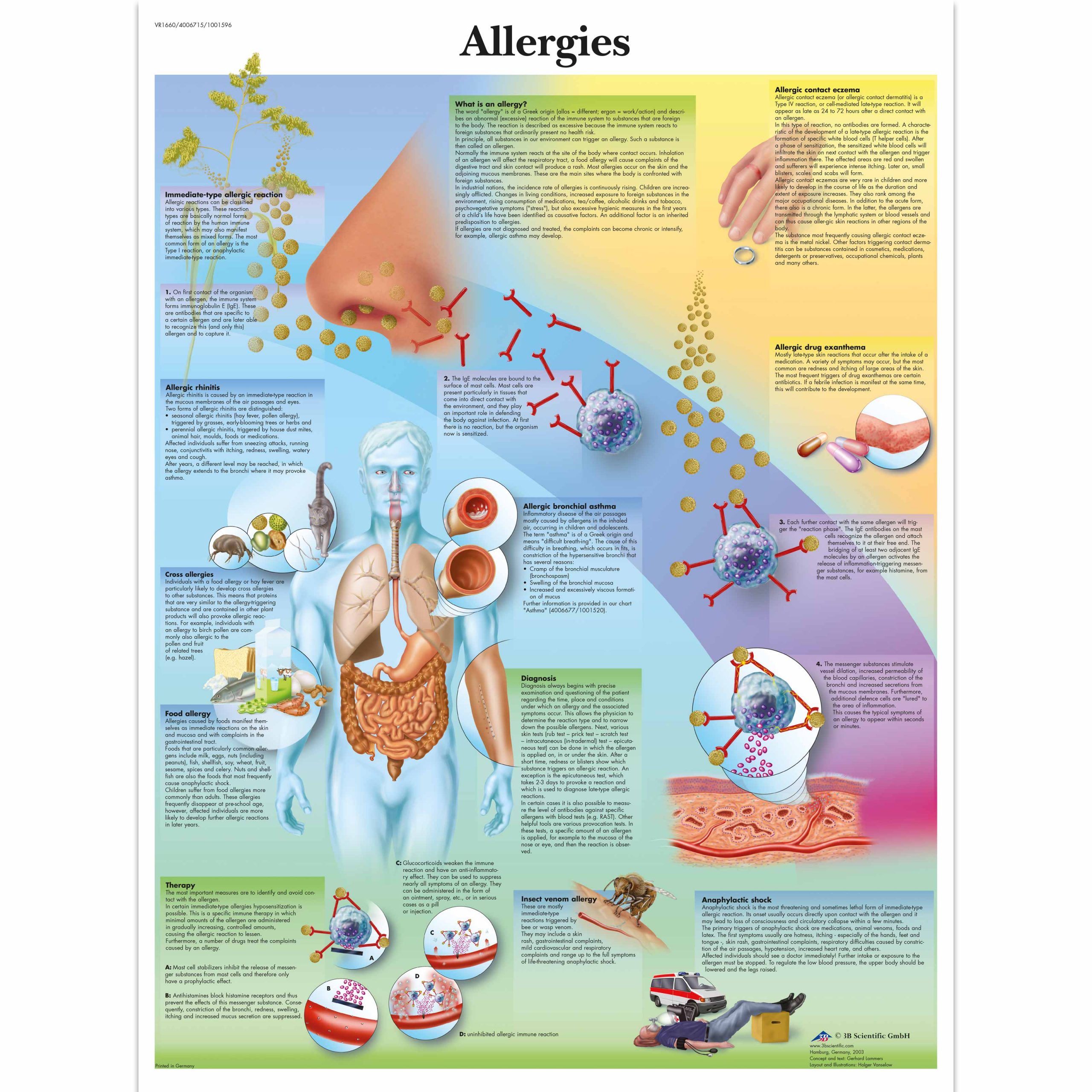 Allergies Chart - SEM Trainers