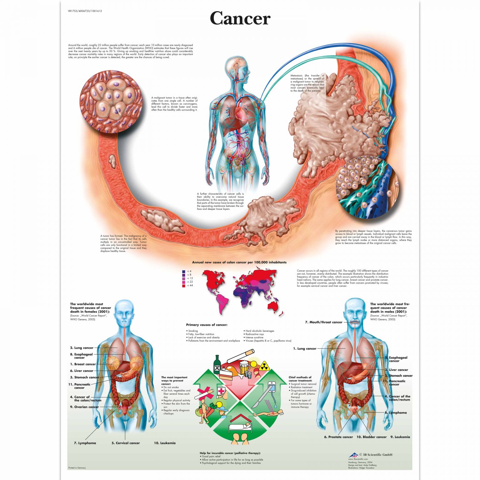 Skin Cancer Chart - SEM Trainers