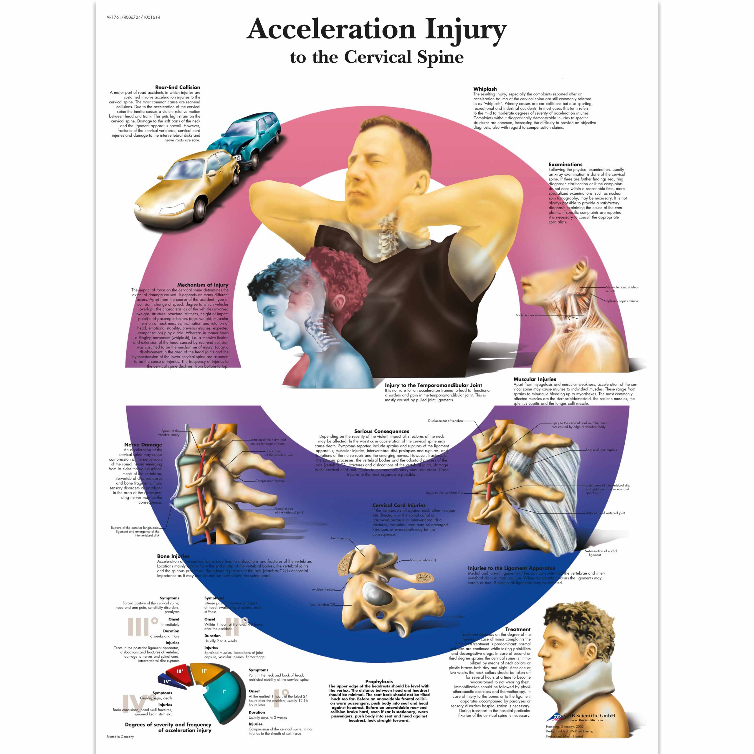 Acceleration Injury to the Cervical Spine Chart - SEM Trainers