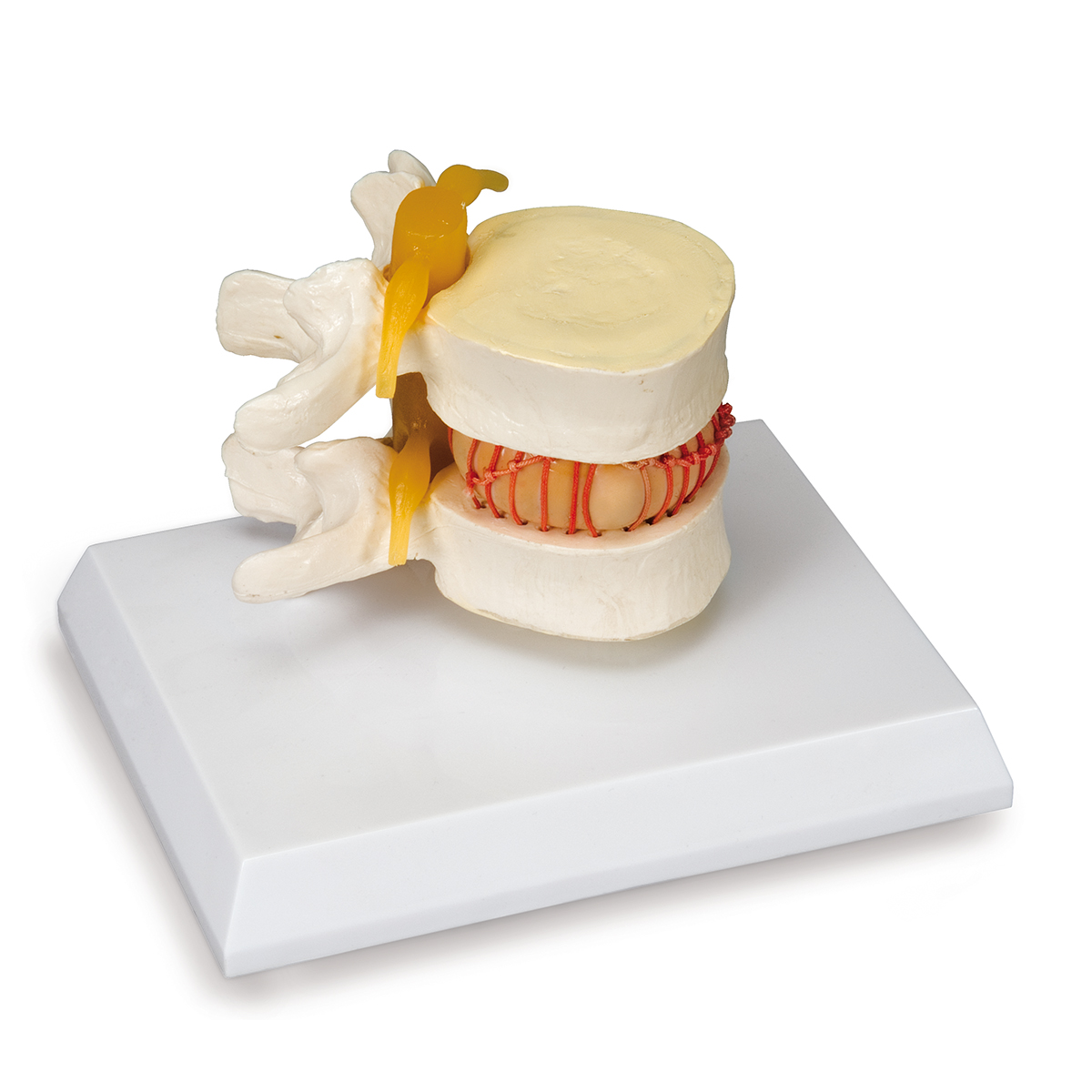 Herniated Disc Simulator - SEM Trainers