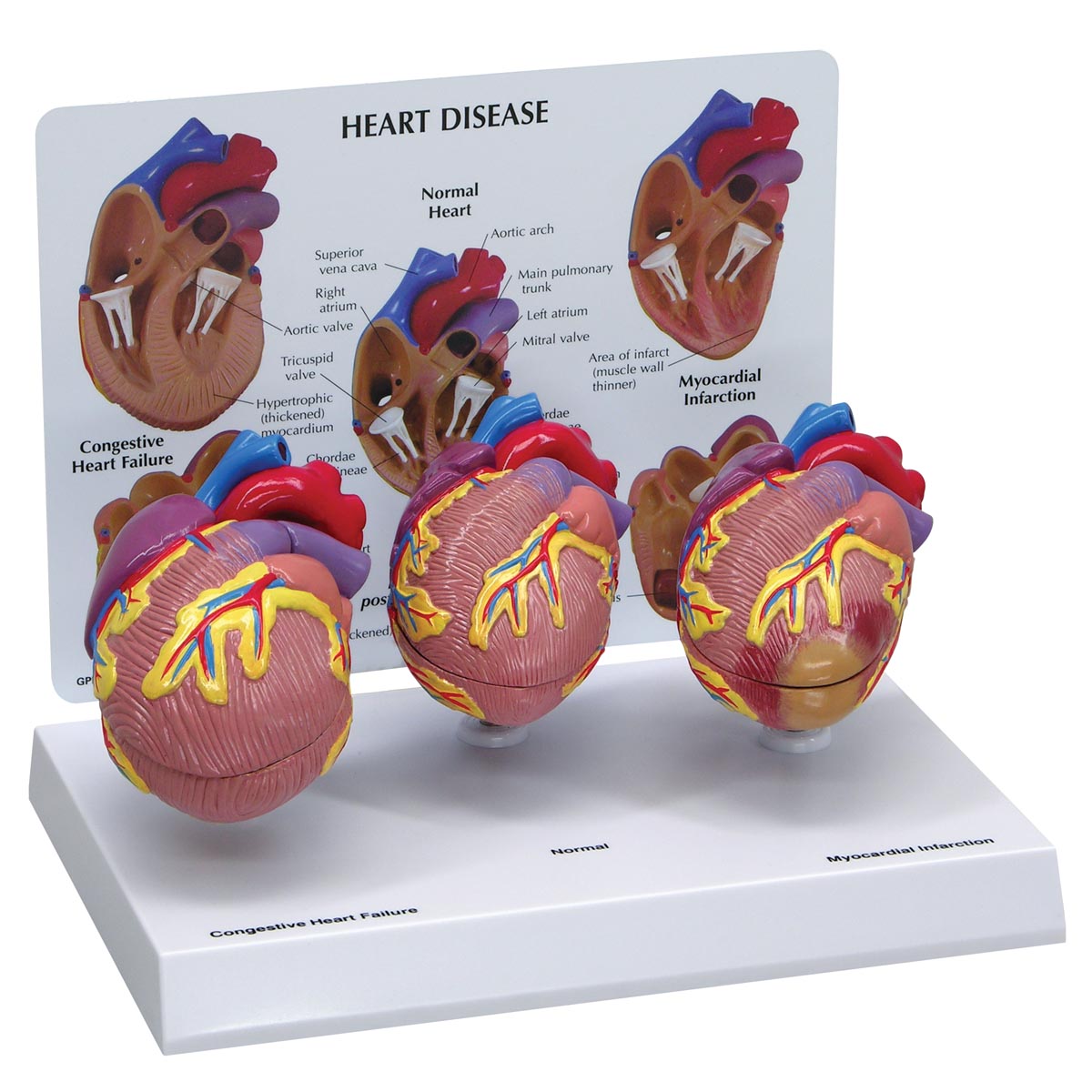 3-Mini Heart Model Set - SEM Trainers