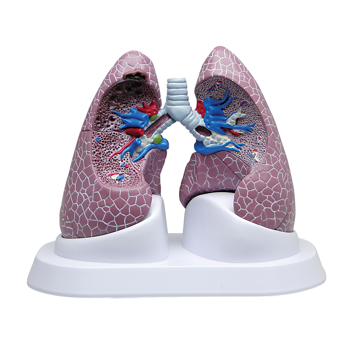Lung Set with Pathologies - SEM Trainers