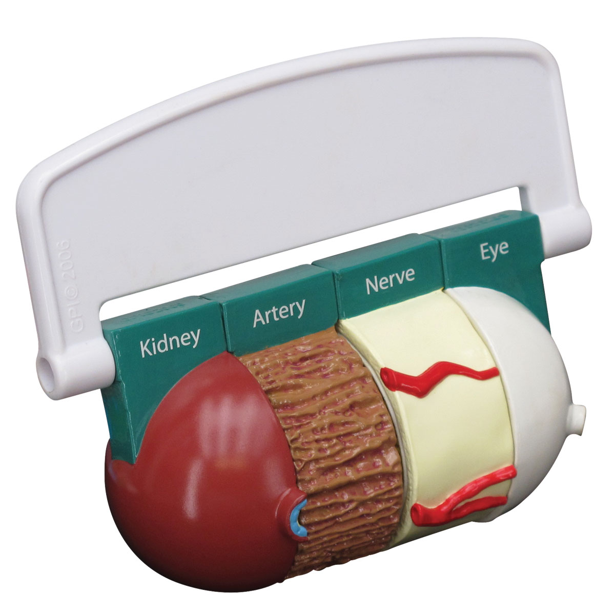 4-Piece Diabetes Model - SEM Trainers