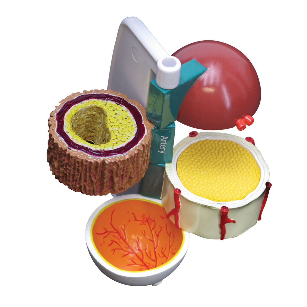 4-Piece Diabetes Model - SEM Trainers