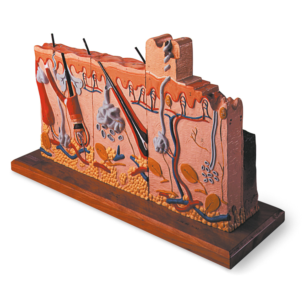 Human Skin Series with Burn Pathologies, 75 times life size - SEM Trainers