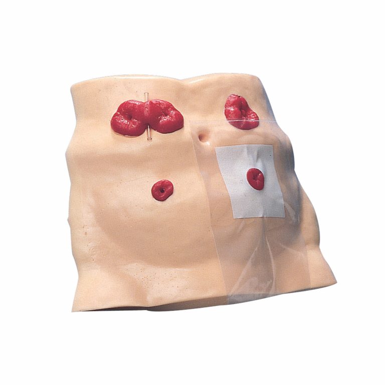 Life/form® Ostomy Care Training Models Set - SEM Trainers