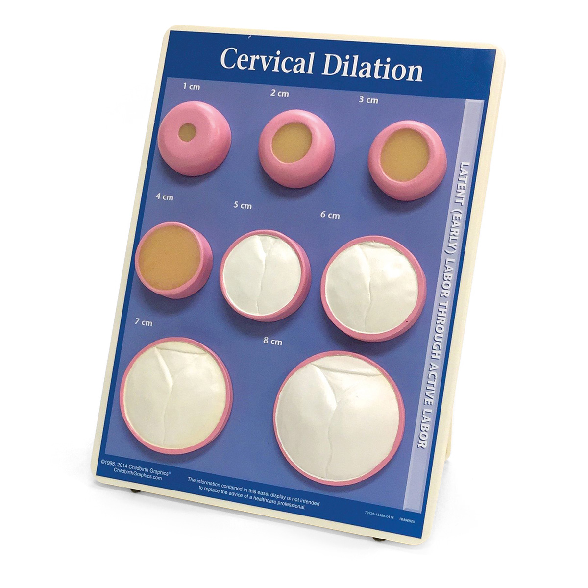 Cervical Dilation Easel Display - SEM Trainers