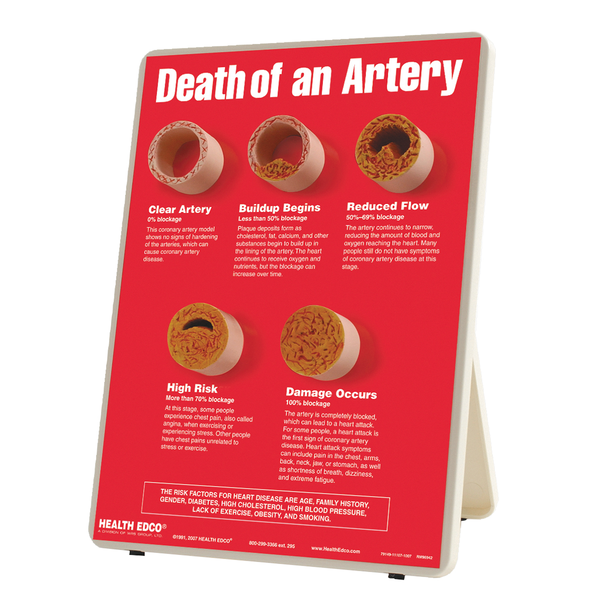 Death of An Artery Easel Display - SEM Trainers