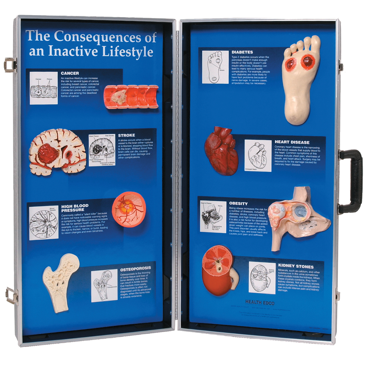 Consequences of An Inactive Lifestyle 3D Display - SEM Trainers
