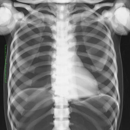 X-Ray Training Phantom PBU-POSE - SEM Trainers