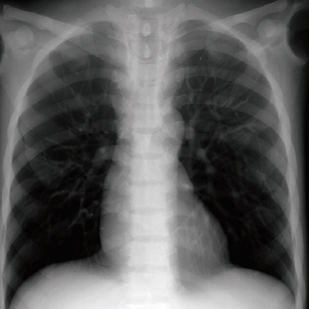 Whole Body Phantom "PBU-50" - SEM Trainers