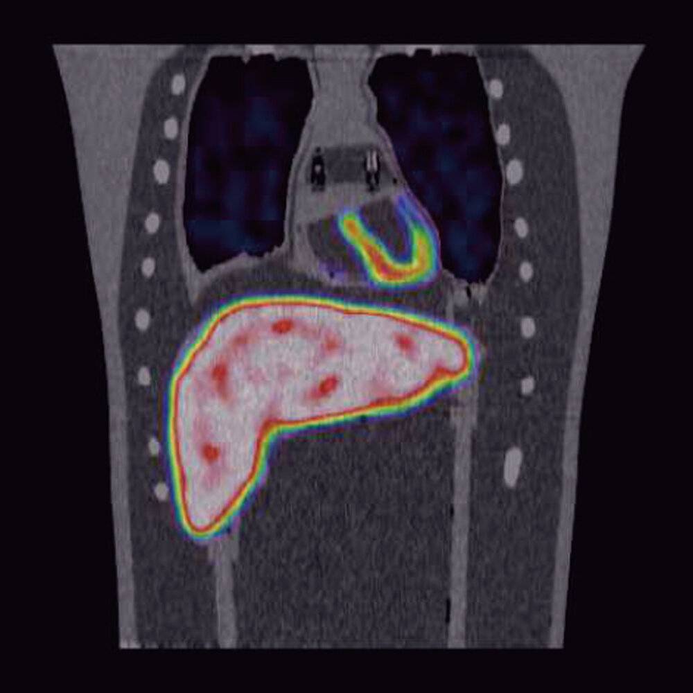 PET/SPECT Thorax Phantom - SEM Trainers