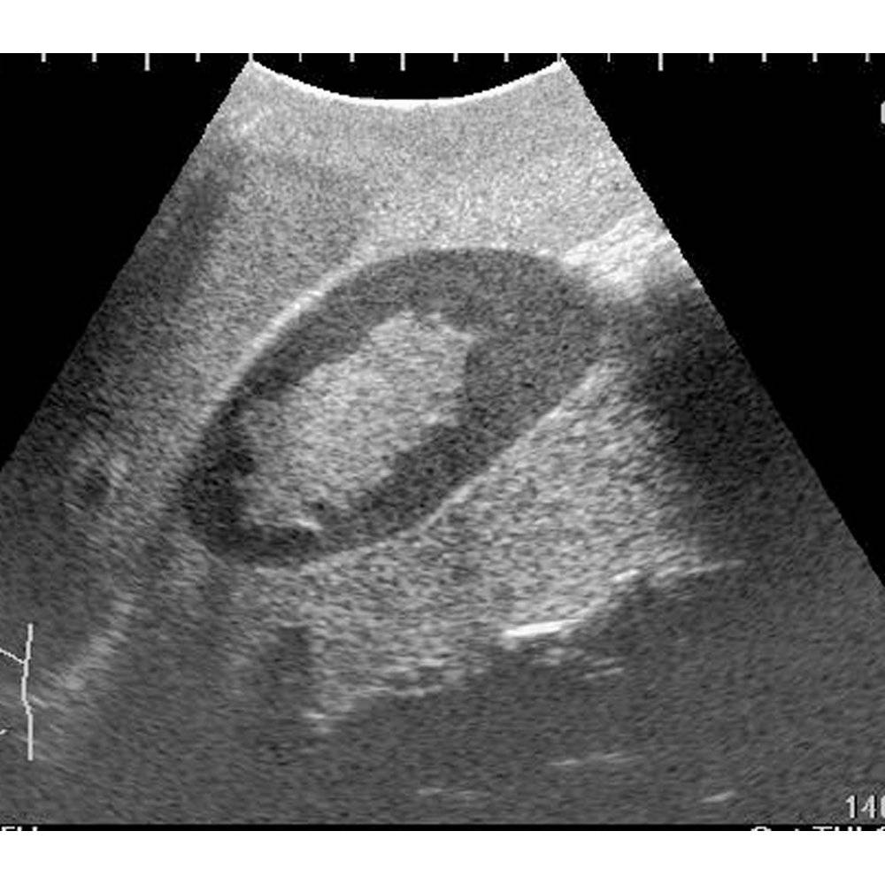 Ultrasound Examination Training Phantom "ECHOZY" - SEM Trainers